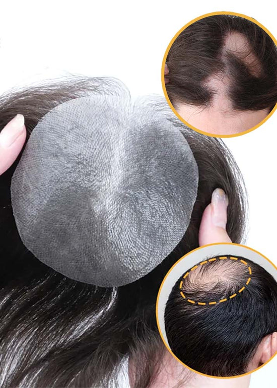 COVER UP HAIR PATCH | Bald Spot Replacement Hair System | Patchy ...